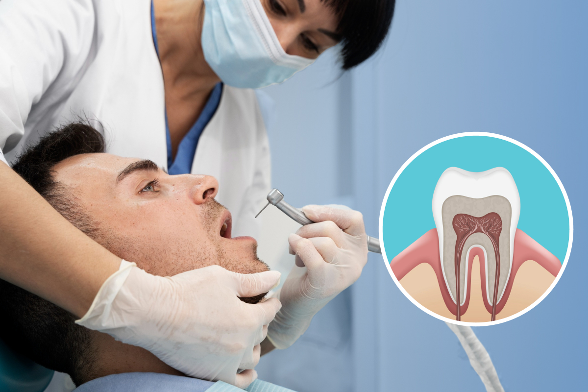 What is Root Canal Treatment?