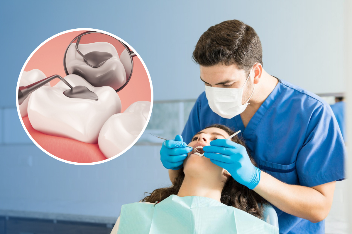 How Long do Dental Fillings Last?